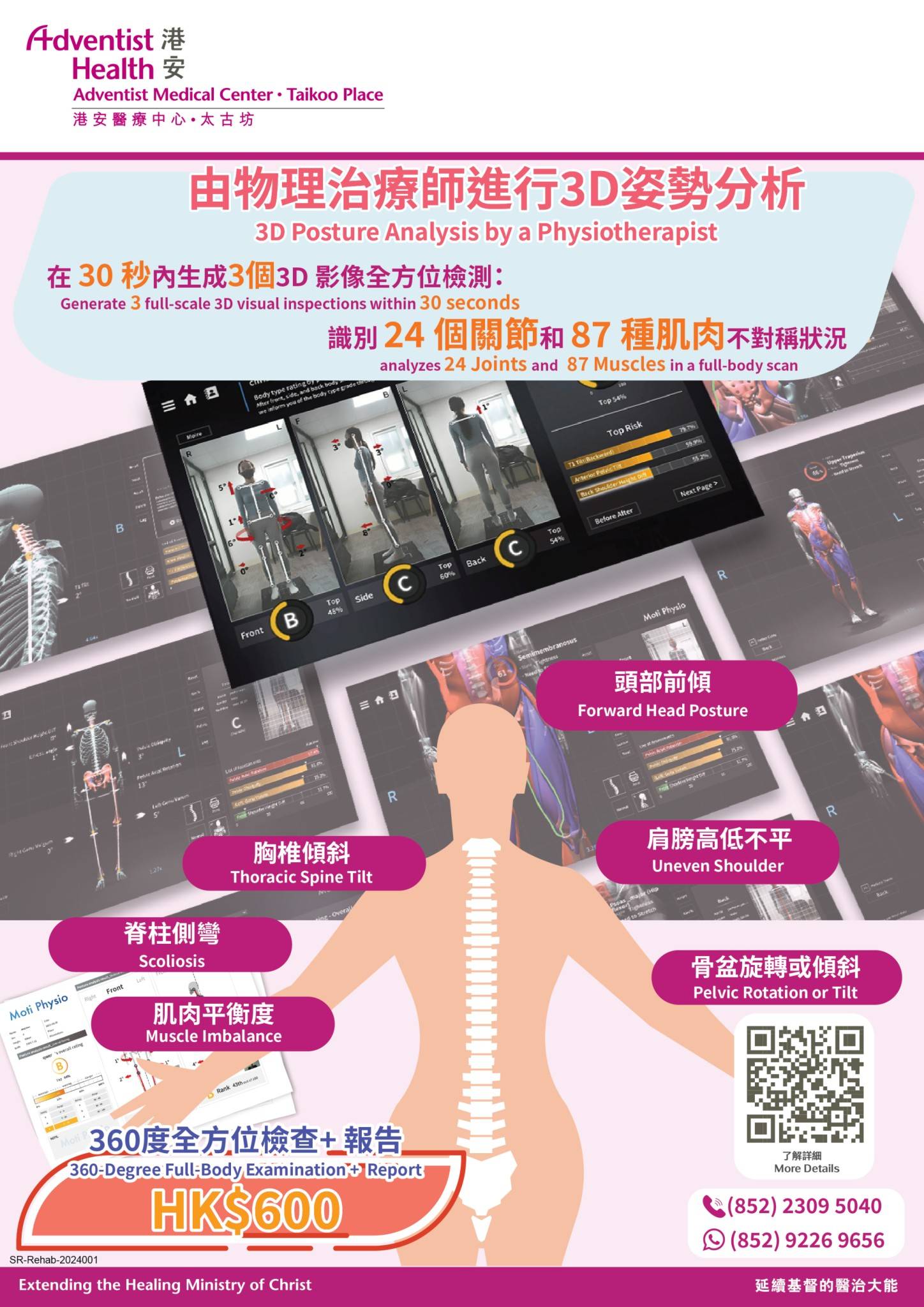 AI-Powered 3D Posture Analysis Service - Adventist Medical Center